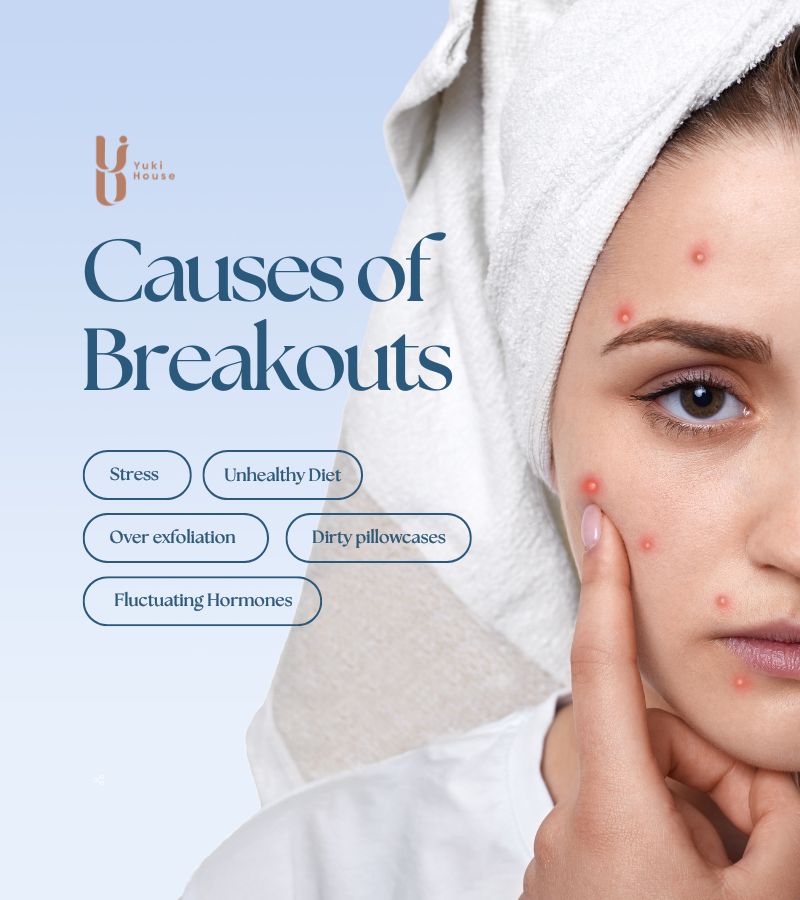 Acne Treatment | Oil Control